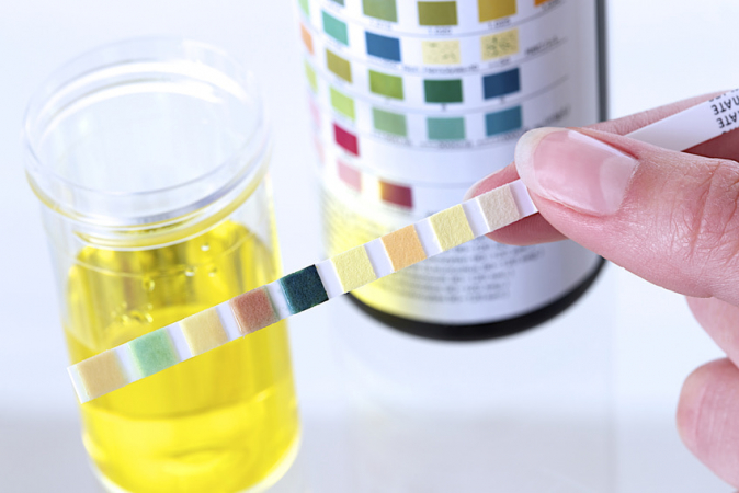 Infections Urinaires Urologie Foch